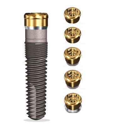 Health Management and Leadership Portal | Conical dental implant ...