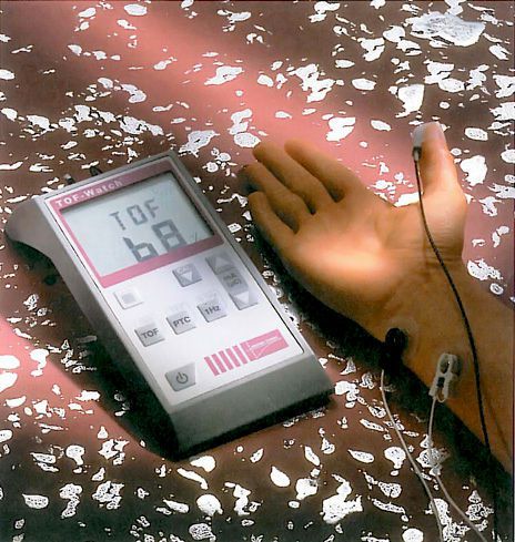 Health Management and Leadership Portal | Acceleromyograph TOF-Watch ...