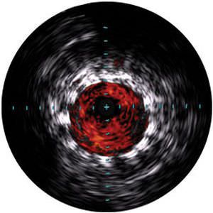 Health Management and Leadership Portal | Catheter guidewire / vascular ...