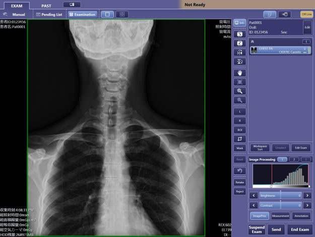 Health Management and Leadership Portal | Radiography system (X-ray ...