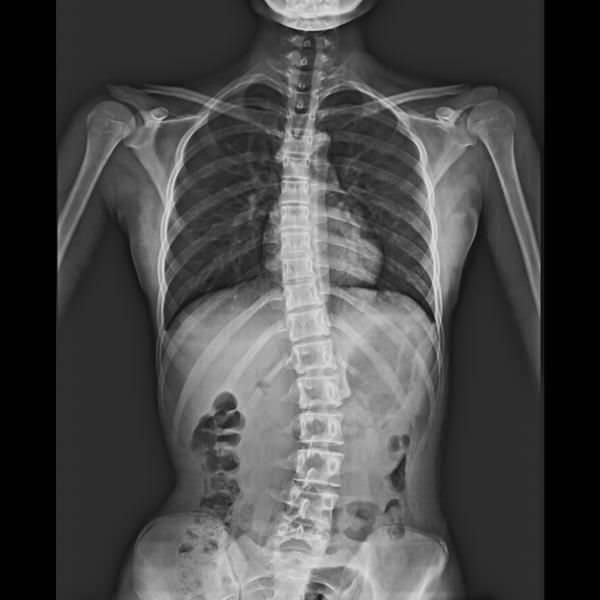 Health Management and Leadership Portal | Radiography system (X-ray ...