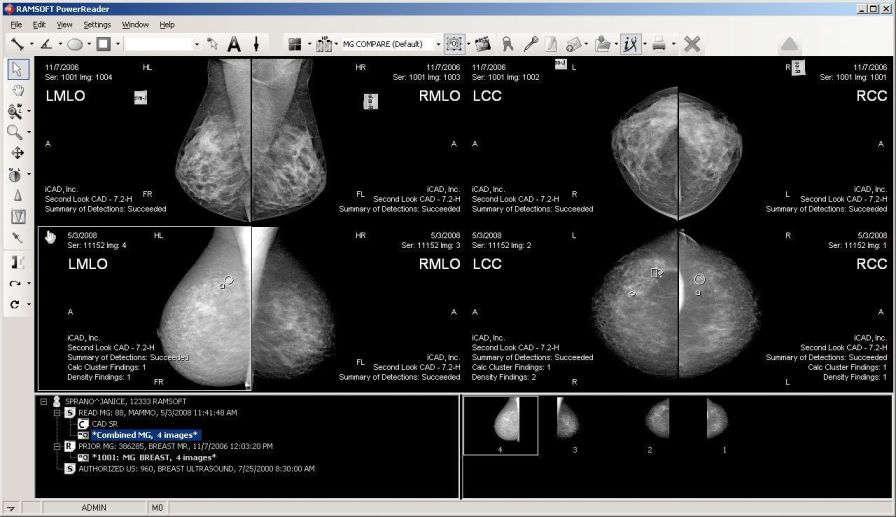 Health Management And Leadership Portal Viewing Software For Mammography Mammo Viewer