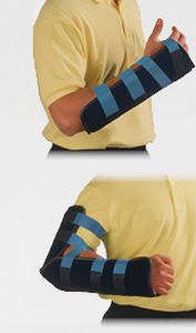 Health Management and Leadership Portal | Forearm splint (orthopedic ...