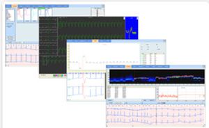 Health Management and Leadership Portal | EEG amplifier BE Plus LTM Ebneuro | HealthManagement.org