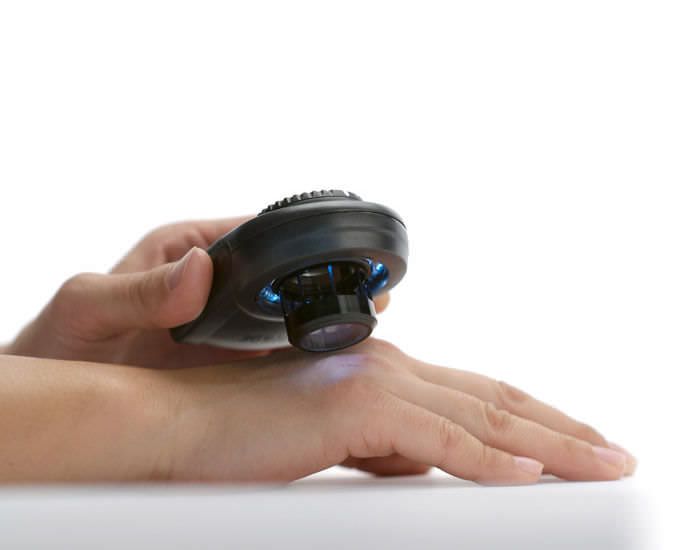 Health Management and Leadership Portal | Dermatoscope with LED light ...