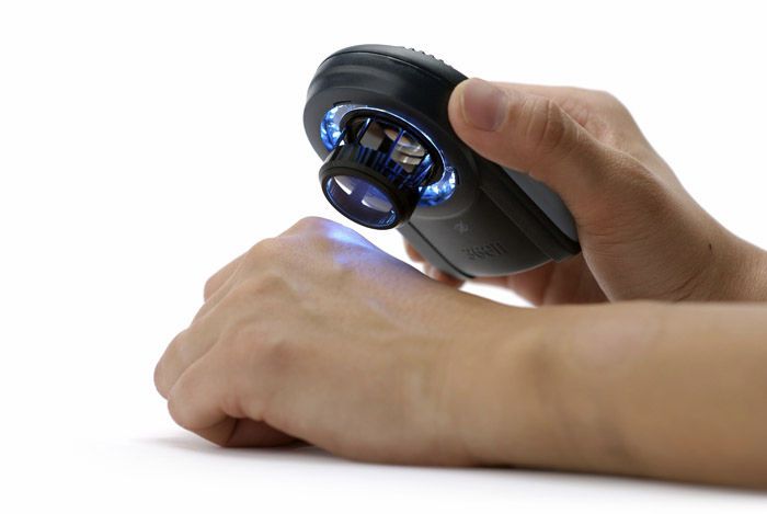 Health Management and Leadership Portal | Dermatoscope with LED light ...