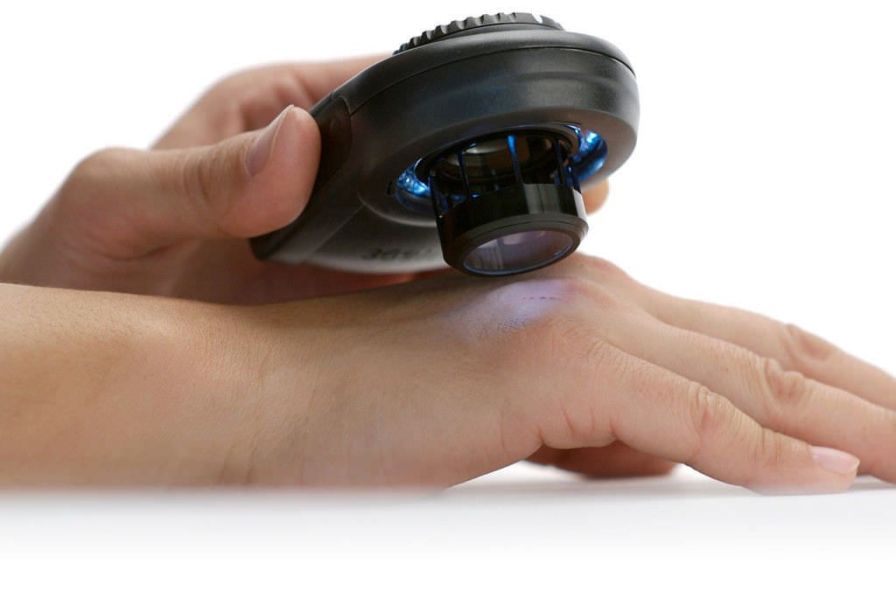 Health Management and Leadership Portal | Dermatoscope with LED light ...