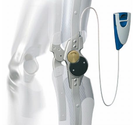 Health Management and Leadership Portal | Prosthetic knee joint (lower ...
