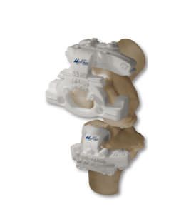 Health Management and Leadership Portal | Knee prosthesis resection ...