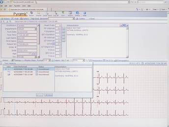 Health Management and Leadership Portal | Digital electrocardiograph ...