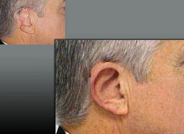 Health Management and Leadership Portal | Auricular external cosmetic ...