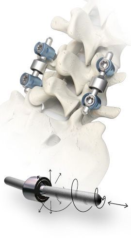 Health Management and Leadership Portal | Cervical interbody fusion ...