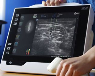 Health Management and Leadership Portal | Portable ultrasound system ...