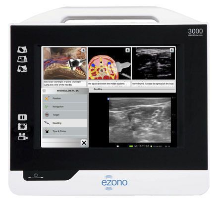 Health Management and Leadership Portal | Portable ultrasound system ...