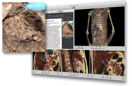 Health Management and Leadership Portal | Virtual dissection table ...