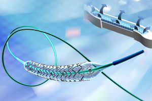 Health Management and Leadership Portal | Coronary stent / drug eluting ...