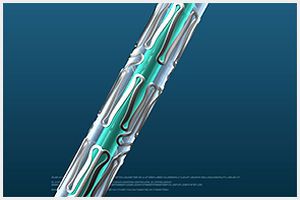 Health Management and Leadership Portal | Thoracic stent graft Hercules ...