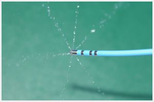 Health Management and Leadership Portal | Coronary stent / drug eluting ...