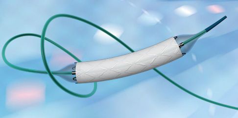 Health Management and Leadership Portal | Coronary stent / drug eluting ...