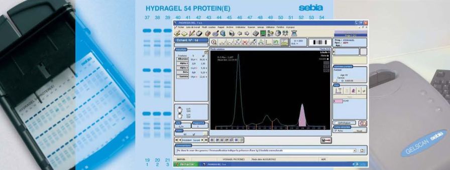 Health Management and Leadership Portal | Electrophoresis densitometer ...