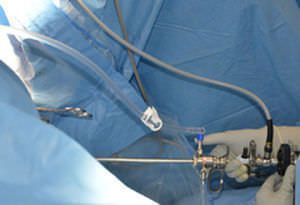 Health Management and Leadership Portal | Endoscopy irrigation pump ...