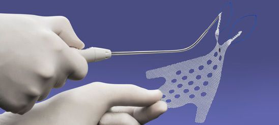 Health Management and Leadership Portal | Reconstruction mesh / pelvic ...