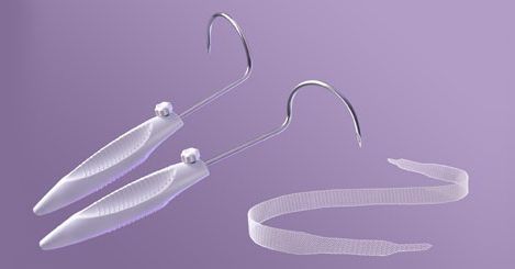 Health Management and Leadership Portal | Urinary incontinence mesh ...