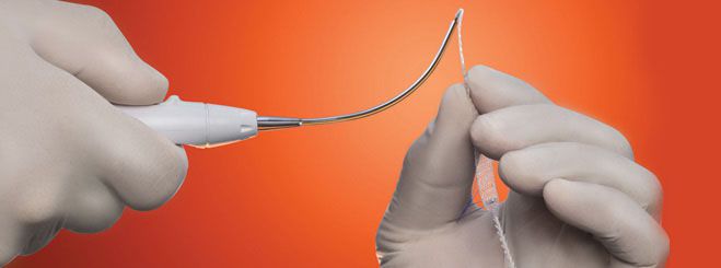 Health Management and Leadership Portal | Reconstruction mesh / pelvic ...