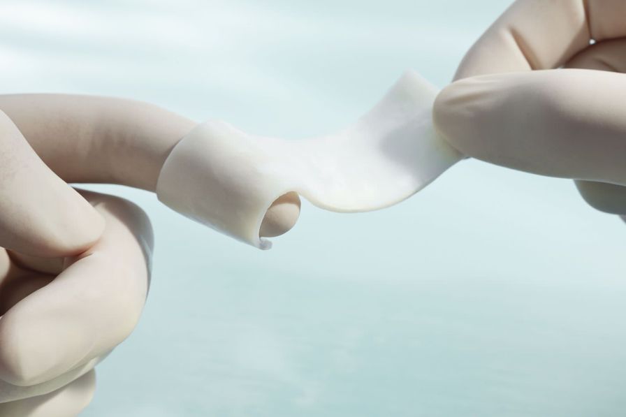 Health Management and Leadership Portal | Dura substitution prosthesis ...