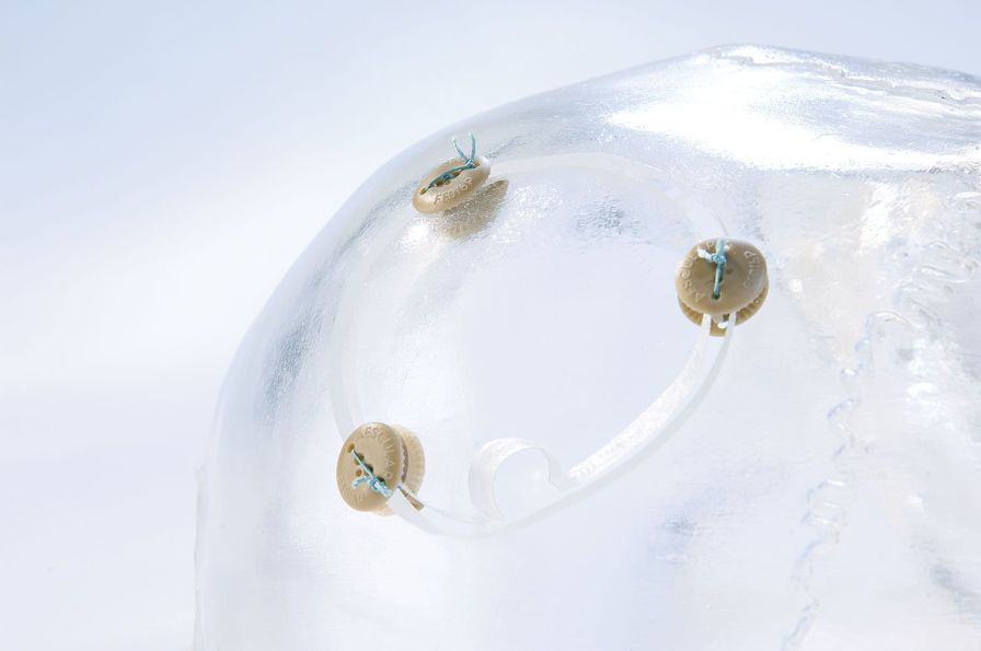 Health Management and Leadership Portal | Skull surgery clamp CranioFix ...