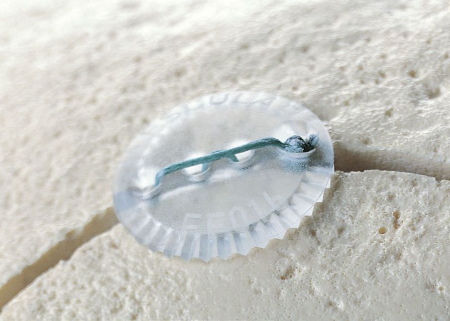 Health Management and Leadership Portal | Skull surgery clamp CranioFix ...