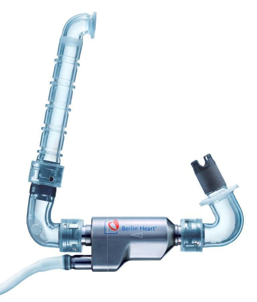 Health Management and Leadership Portal | Ventricular assist device ...