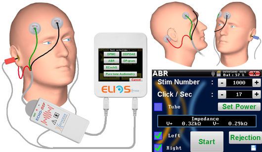Health Management and Leadership Portal | Evoked auditory potential measurement system ...