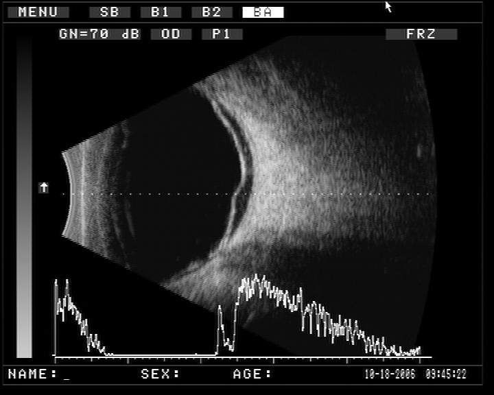 Health Management and Leadership Portal | Ophthalmic biometer ...