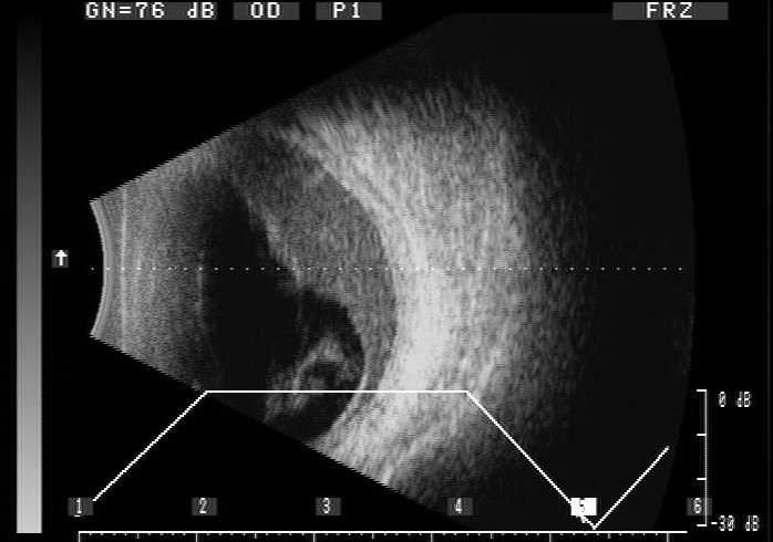 Health Management and Leadership Portal | Ophthalmic biometer ...