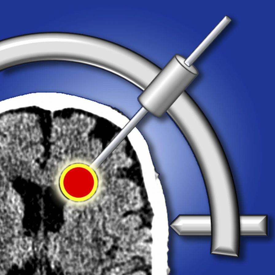 Health Management and Leadership Portal | Preoperative planning ...