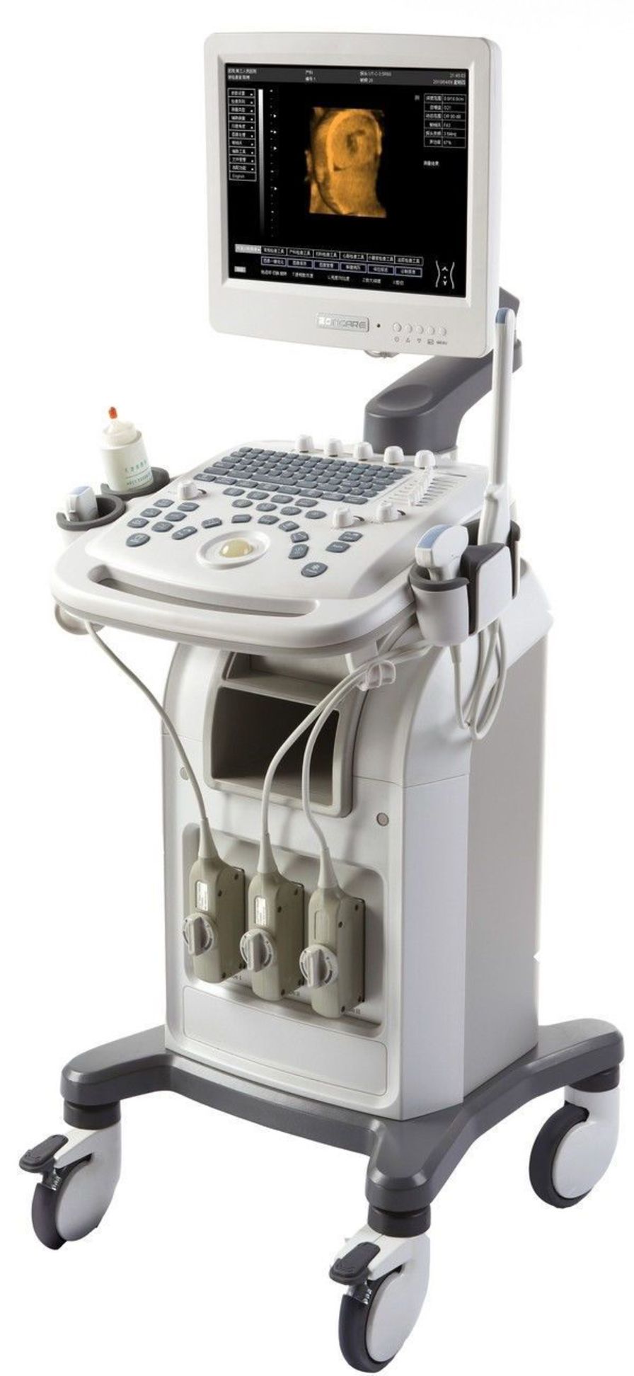 Health Management and Leadership Portal | Portable ultrasound system ...