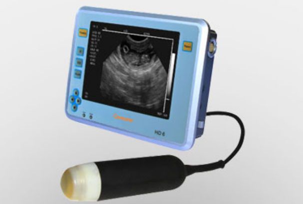 Health Management and Leadership Portal | Portable ultrasound bladder ...