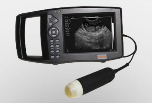 Health Management and Leadership Portal | Portable ultrasound bladder ...