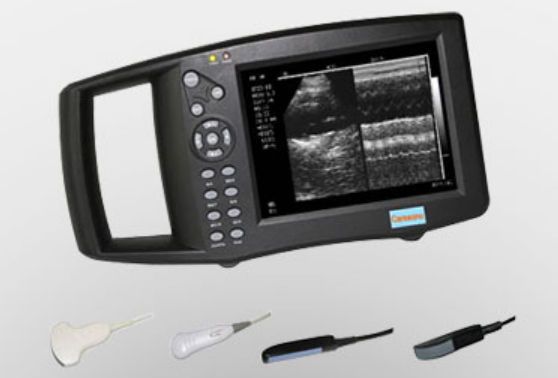 Health Management and Leadership Portal | Portable ultrasound bladder ...