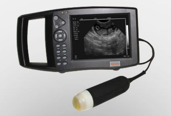 Health Management and Leadership Portal | Portable ultrasound bladder ...