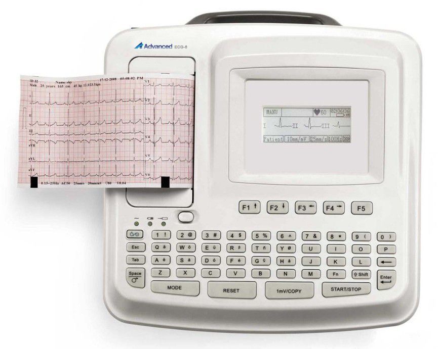 Health Management and Leadership Portal | Digital electrocardiograph ...