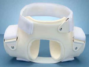 Health Management and Leadership Portal | Hip dysplasia orthosis ...