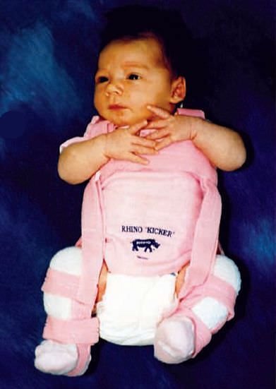 Health Management and Leadership Portal | Pediatric cast shoe RHINO ...