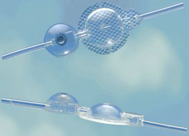 Health Management and Leadership Portal | Hydrocephalus shunt valve ...