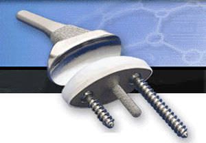 Health Management and Leadership Portal | Total wrist prosthesis ...