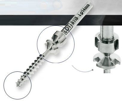 Health Management and Leadership Portal | Tibia osteotomy plate ...