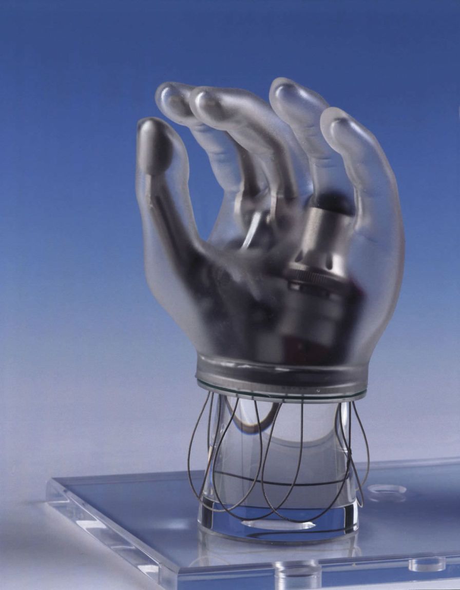 Health Management and Leadership Portal | Hand prosthesis (upper ...