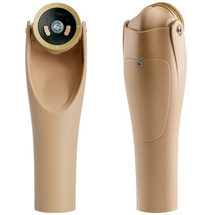 Health Management and Leadership Portal | Elbow external prosthesis ...