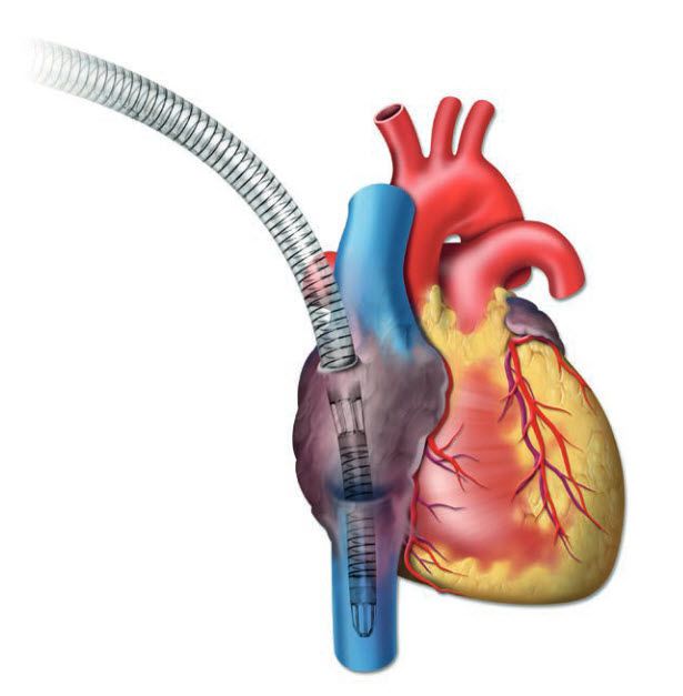 Health Management and Leadership Portal | Implantable cardiac ...